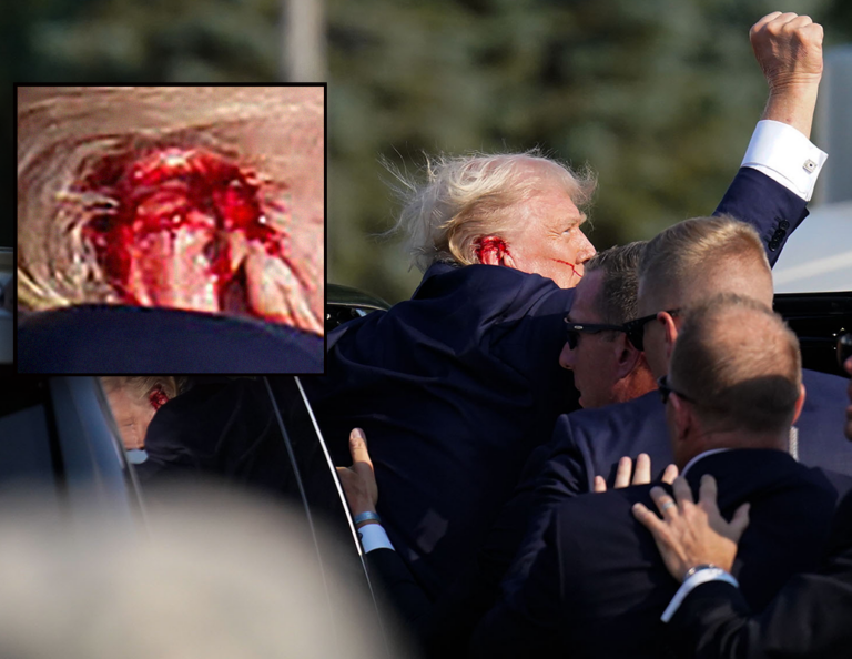 Shot Ripped OFF Piece Of Trump’s Ear … CLOSE UP PICS! (Graphic)