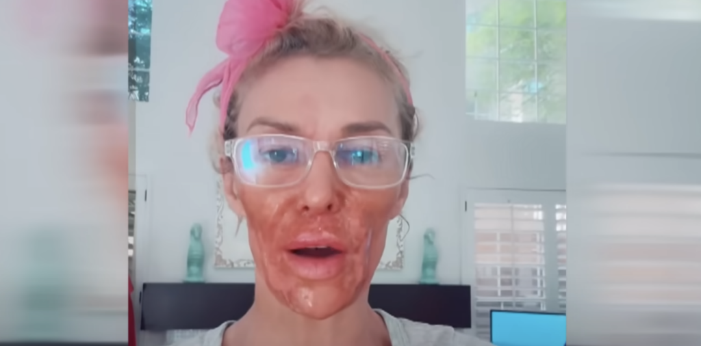 Brandi Discusses Her Battle with Bone Infection